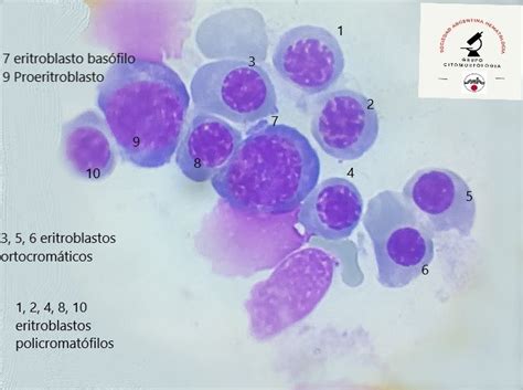 sociedad argentina de hematología