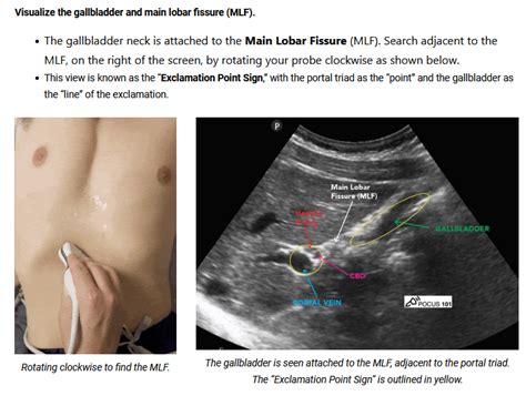Main Lobar Fissure Ultrasound