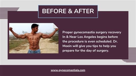 Ppt One Of The Best Gynecomastia Aftercare Instructions Powerpoint