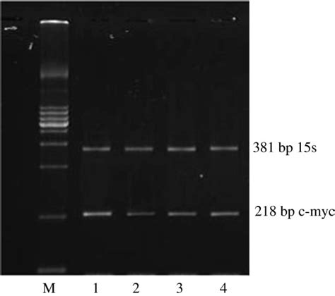 Expression Of C Myc Oncogene In Untreated 1 And Treated 2 3 4
