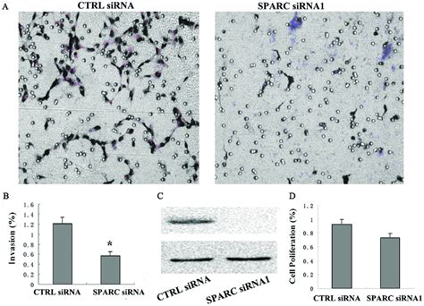 Silencing The Expression Of Sparc By Rnai Resulted In Decreased
