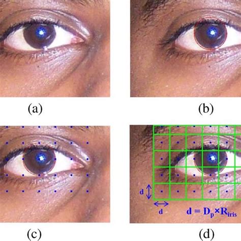 Schematic Of Image Alignment And Feature Extraction Process A Input