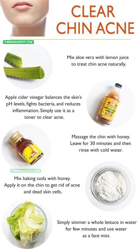 Pimples On Chin Meaning How To Get Rid Of Break Out On Chin Artofit