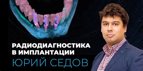 Проектирование сложных хирургических шаблонов Поэтапный протокол Часть 1