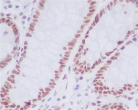 Lsd1 Antibody Sr1059 Novus Biologicals 50 μg Unconjugated