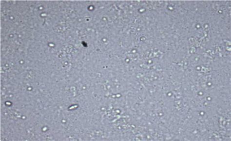 Formulated Phytosomes Of Vitex Negundo Linn Download Scientific Diagram