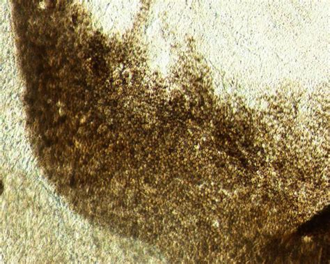 Human Retinal Pigment Epitheli Image Eurekalert Science News Releases