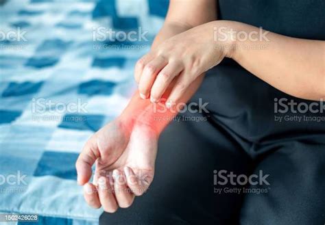 집에서 손으로 가려움증을 긁는 여자 팔을 닫고 발진 곰팡이 알레르기 피부병 건조한 피부로 인한 가려움증 건강 관리 및 의료
