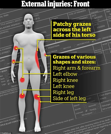 Full Horror Of Oklahoma Teen Noah Presgroves Injuries Explained As
