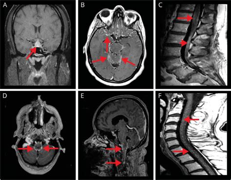 Examples Of Typical Ns Mri Findings Download Scientific Diagram