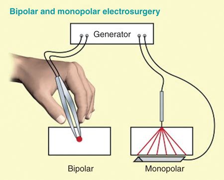 Surgical Instruments Anesthesia Key