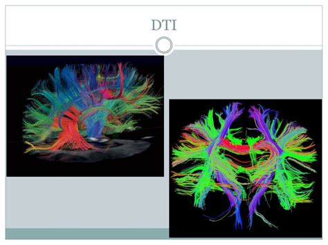 Ppt Intraoperative Mapping Of The Corticospinal Tracts With