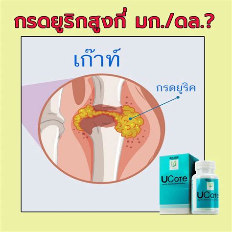 📌🔥กรดยูริกในเลือดสูง Hyperuricemia ภาวะกรดยูริกในเลือดสูง เป็นความผิด