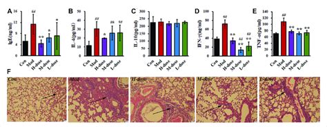 Sxcf Reduces The Expression Of Relevant Cytokines In Serum And Balf And