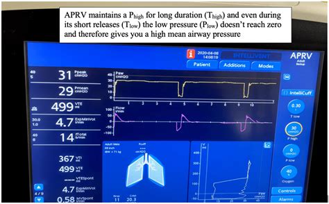 Aprv Settings Rebel Em Emergency Medicine Blog