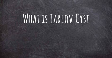 What Is Tarlov Cyst