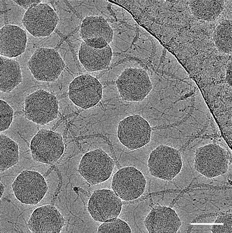 Bacteriophage Electron Micrograph