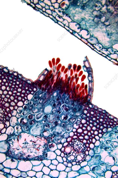 Rust Fungus In A Leaf Light Micrograph Stock Image C Science Photo Library