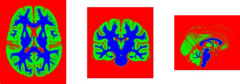 Template Generated From Fitting The Generative Model To All Of The