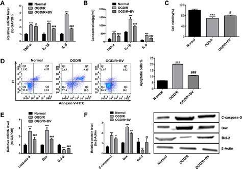 Biliverdin Protects Against Cerebral Ischemia Ndt Ndt