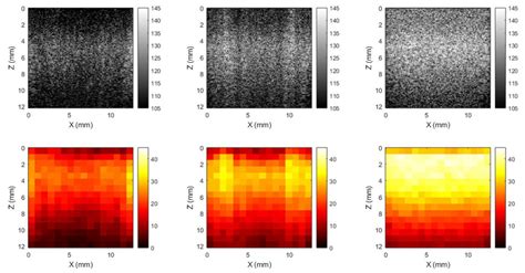 B Mode Images A C And Signal To Noise Ratio Images DB D F Of A Download Scientific