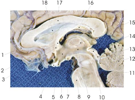 3 Sagittal Midbrain Diagram Quizlet