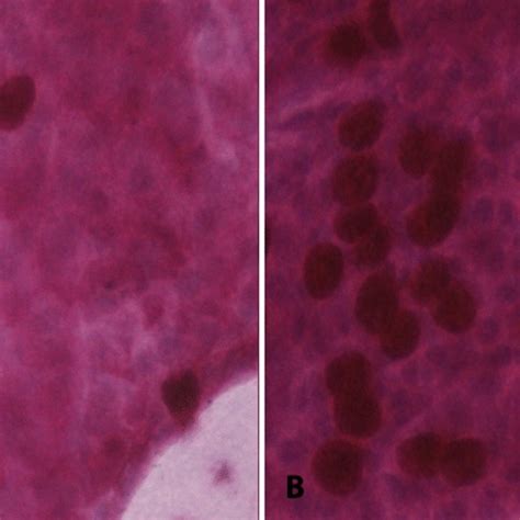Diagram Of Ocular Surface Staining Divisions Of The Cornea Above And Download Scientific
