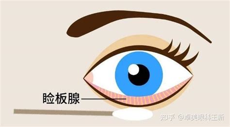 1分钟读懂干眼检查 知乎