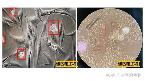 如何清除真菌污染 迪医明生物 知乎