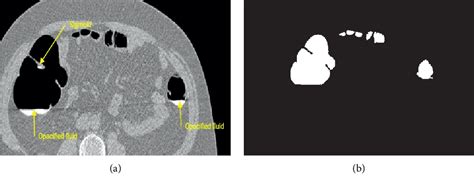 Figure 4 From Automatic Detection And Segmentation Of Colorectal Cancer With Deep Residual