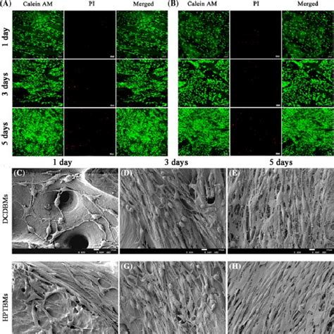 Use Of Acellular Dermal Matrices In Breast Reconstruction Acellular