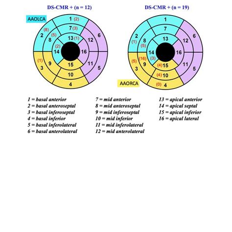 Distribution Of Regional Inducible Hypoperfusion In Aaolca And Aaorca