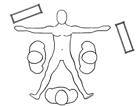 Position Of An Operator And Assistants During The Laparoscopic Distal Download Scientific