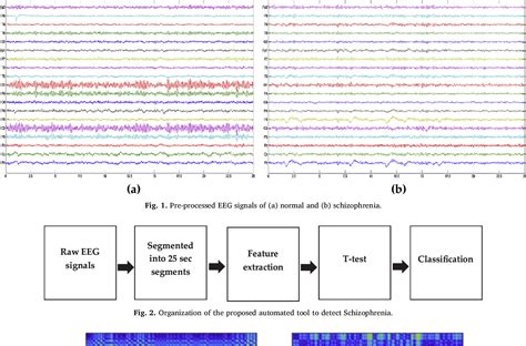 Figure 1 From Automated Detection Of Schizophrenia Using Nonlinear
