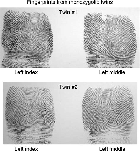 Figure 1 From Friction Ridge Skin Morphogenesis And Overview Anatomy
