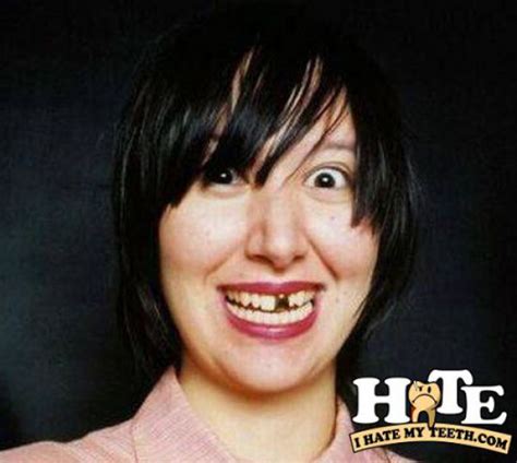 The Worst Teeth Ever 31 Pics