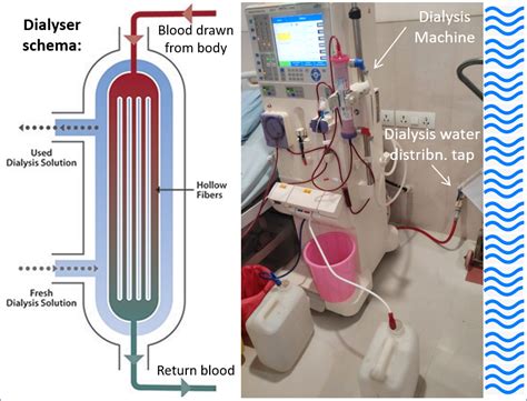 Dialysis Water Specification At Cristina Vu Blog