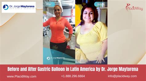 Best Surgeons For Gastric Balloon In Latin America
