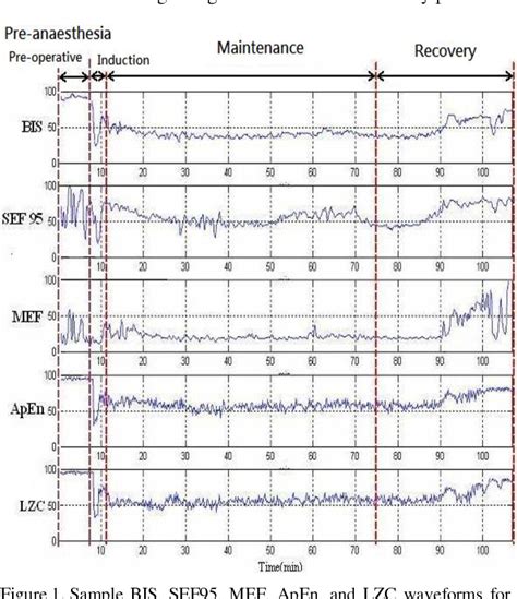 Figure 1 From Comparison Of Eeg Approximate Entropy And Complexity Measures Of Depth Of