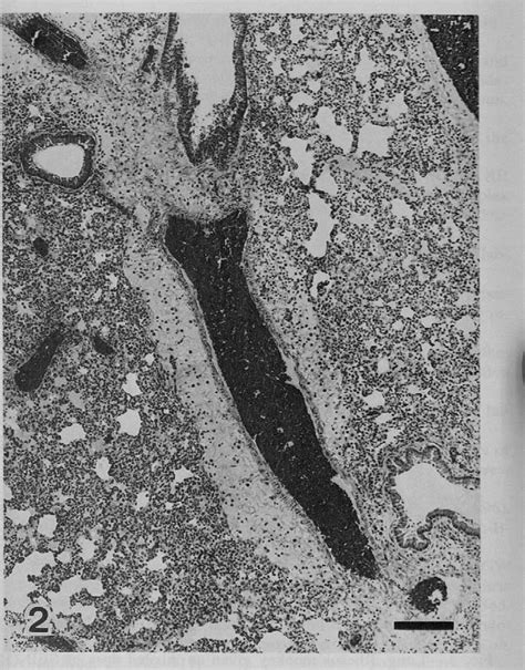 Lung Balb C Mouse After A Lethal Inhaled Dose Of Seb 49 P G Kg Download Scientific Diagram