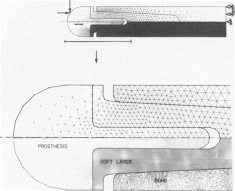 A Finite Element Model Of The Prosthesis Bone Configuration The Full Download Scientific