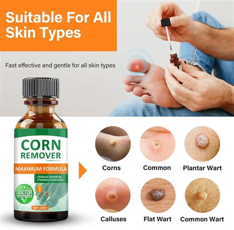 Corn Remover For Feet 30ml Effect Corn Removal Liquid