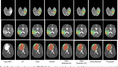 Figure 5 From Multi Scale Self Guided Attention For Medical Image