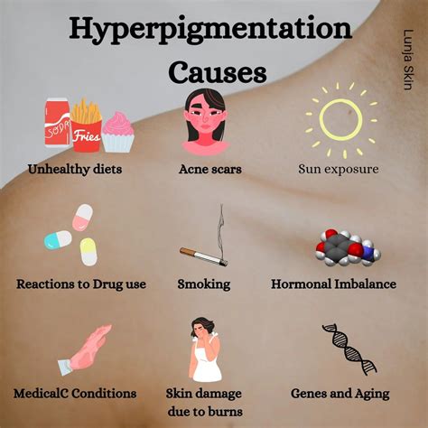 Acne Triggers Artofit