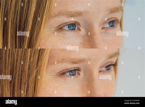 Comparison Of Female Eyes Before And After Eyelash Extension Stock