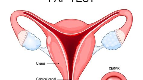 Why Regular Pap Smears And Hpv Tests Are Crucial For Womens Health