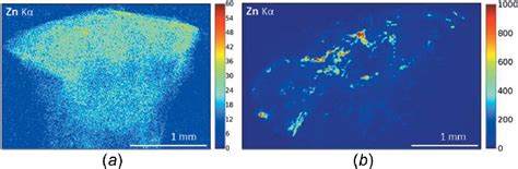 Xrf Maps Spatial Distribution Of Zn A Patient 11 Zn Is Diffusely