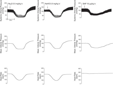 Analysis Of Cardiovascular Responses To The H2s Donors Na2s And Nahs In