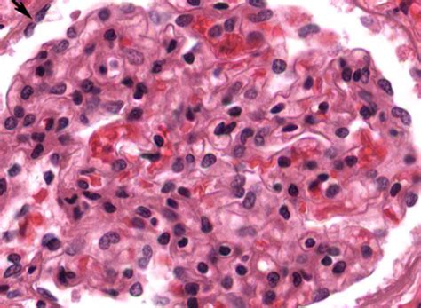 Tissues Lab Anatomy Flashcards Quizlet Tissues Lab Anatomy Flashcards Quizlet