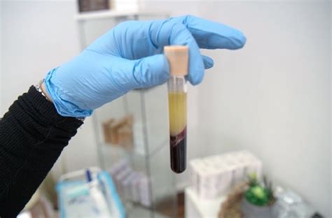 What Is The Difference Between Plasma And Serum Hubpages